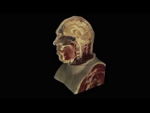 The Visible Human Project and Its Role in Medical Research