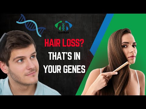 Genetic Insights into the Baldness Gene and Hair Loss