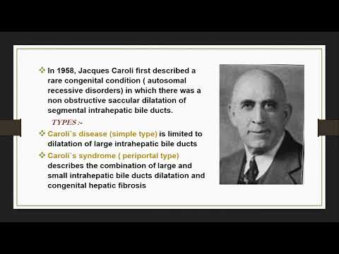 Radiological Insights into Caroli Disease Management